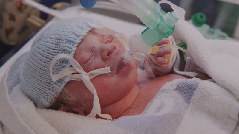Unborn Baby Saved by Pioneering Operation in Leicester
